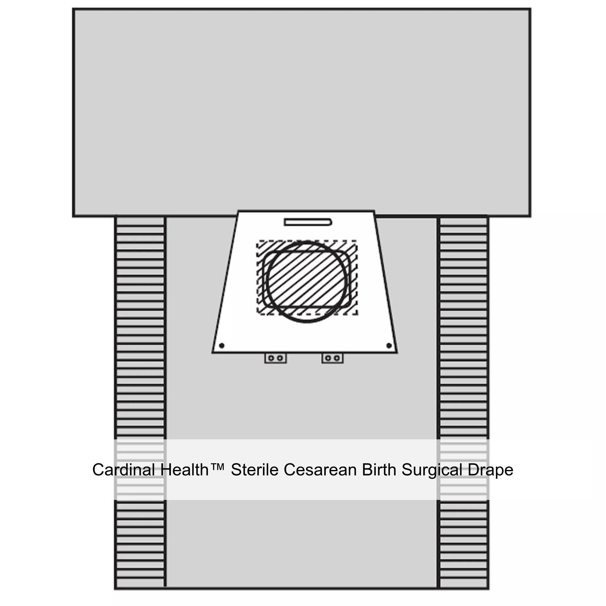 Cardinal Health™ Sterile Cesarean Birth Surgical Drape, 77 x 122IN ...