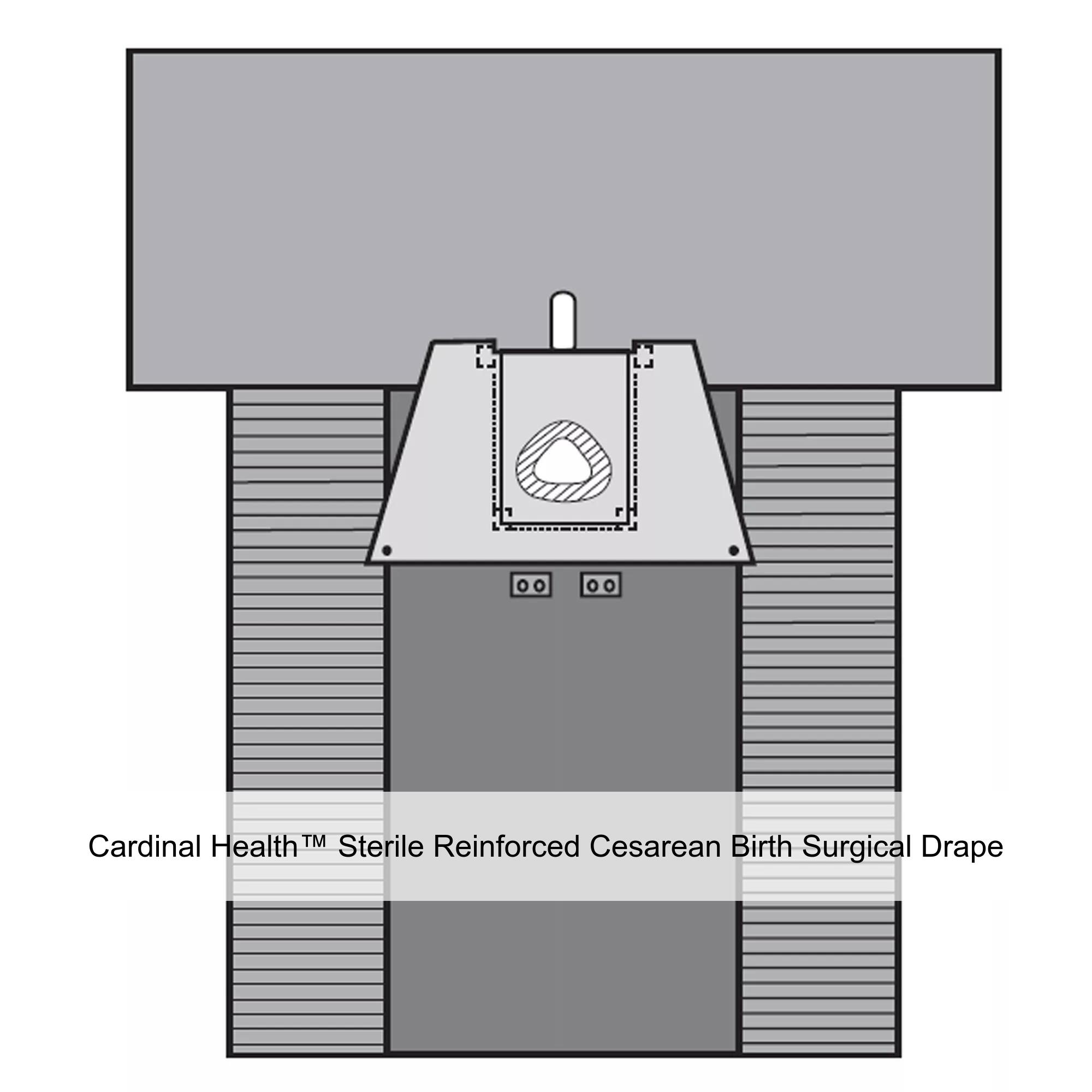 Cardinal Health™ Sterile Reinforced Cesarean Birth Surgical Drape, 77 x ...