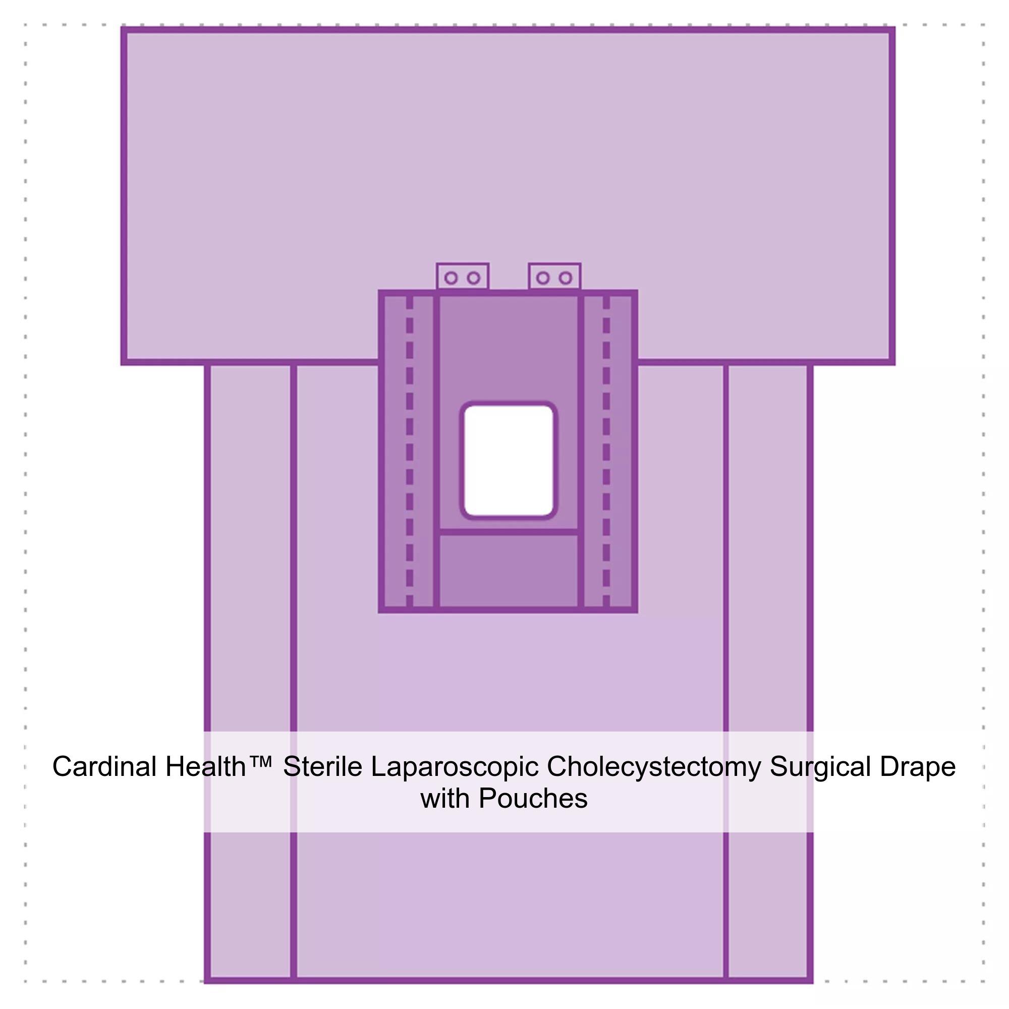 Cardinal Health™ Sterile Laparoscopic Cholecystectomy Surgical Drape ...